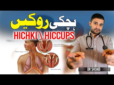 Hichki Kaise Band Kare || Hiccups Treatment in Urdu/Hindi