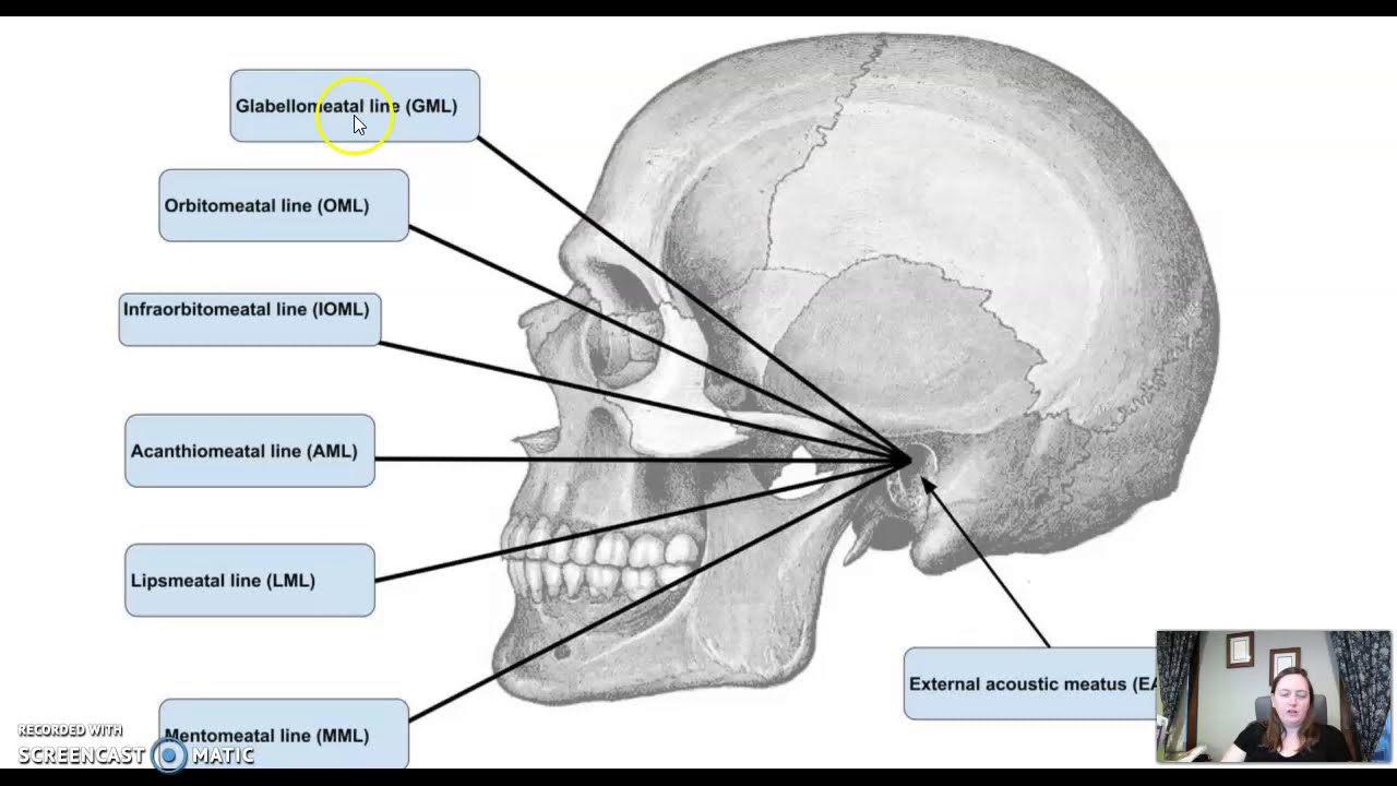 ARRT procedures part #2 Head