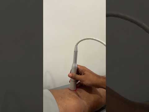 Say Goodbye to Knee Pain Forever! Discover Theal Therapy for Lasting Relief