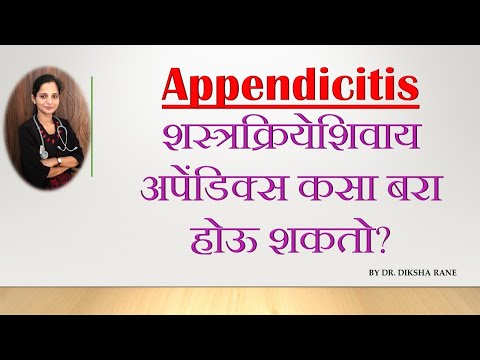 Appendicitis | शस्त्रक्रियेशिवाय अपेंडिक्स कसा बरा होऊ शकतो?