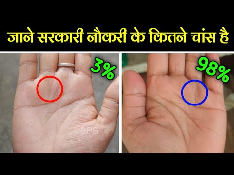 Hath me Sarkari Naukri ki rekha | Government job line