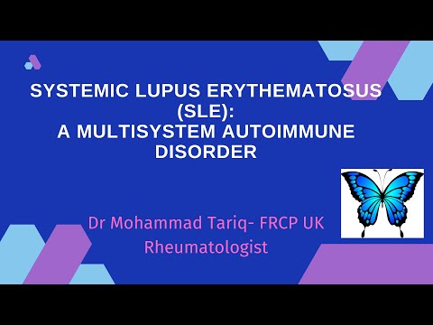 Systemic Lupus Erythematosus, SLE/Lupus