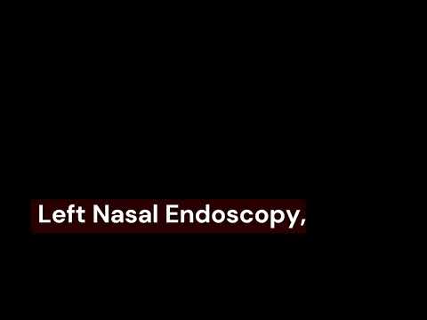 Nasal Endoscopy, Entina ENT Clinic - 24.12.22