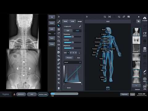 Full-Spine X-ray Stitching Software