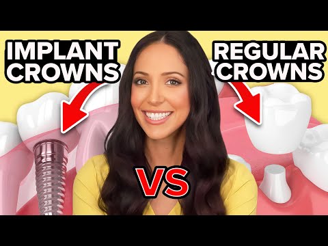 Implant Crowns vs Regular Crowns & How to Clean Them