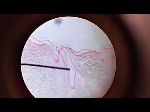 THIN SKIN (SCALP) - HISTOLOGY (Microanatomy) Quick Revision for Exam.