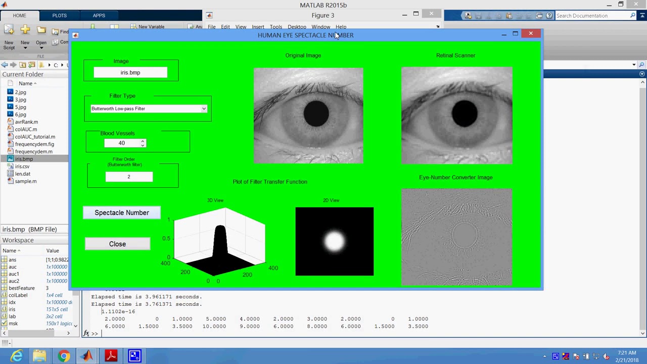 An Intelligent Mobile Application For Determination Of Human Eye ...