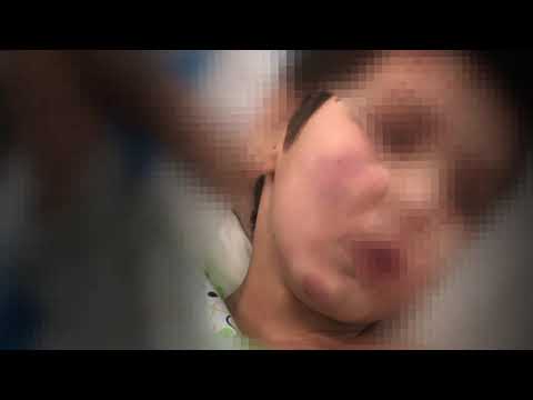 ‘My son could have died.’ Mother blames metro Detroit psych hospital for 7-year-old’s injuries