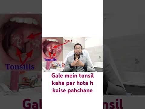 #gale mein tonsil kaha pe hota h kaise pahchane #shortsvideo