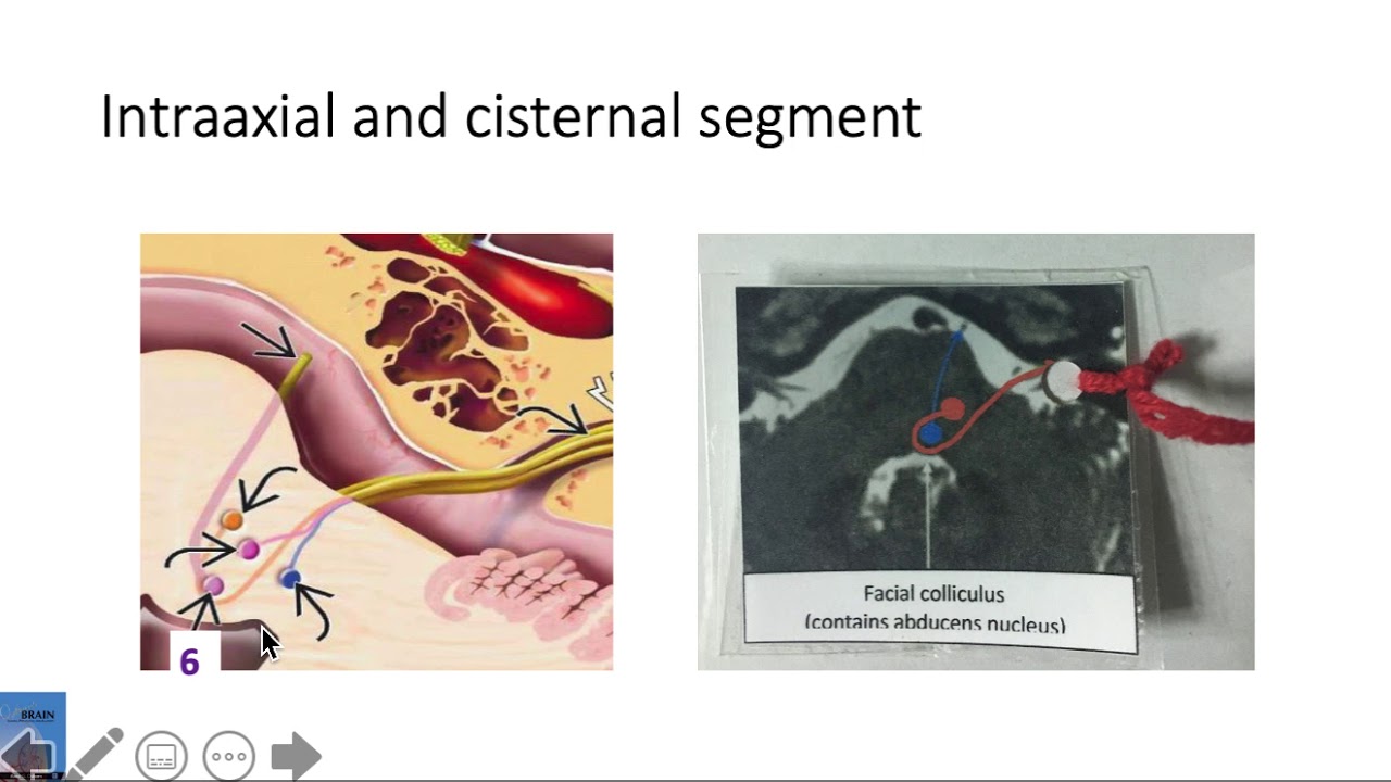 Facial nerve and its course (1/4)- simplified