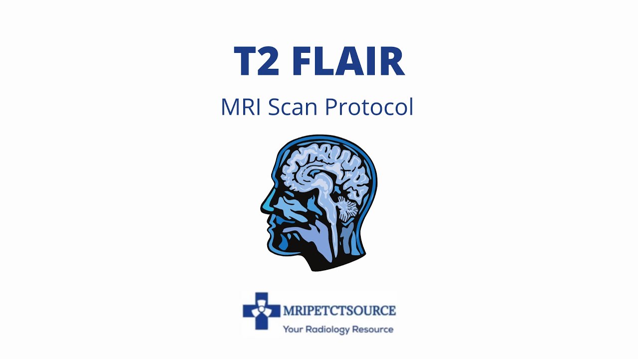MRI Sounds Explained- T2 FLAIR MRI