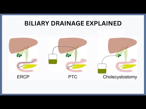 Biliary Drainage Explained