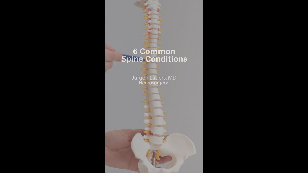 6 Common Spine Conditions That We Treat | 6 in :60