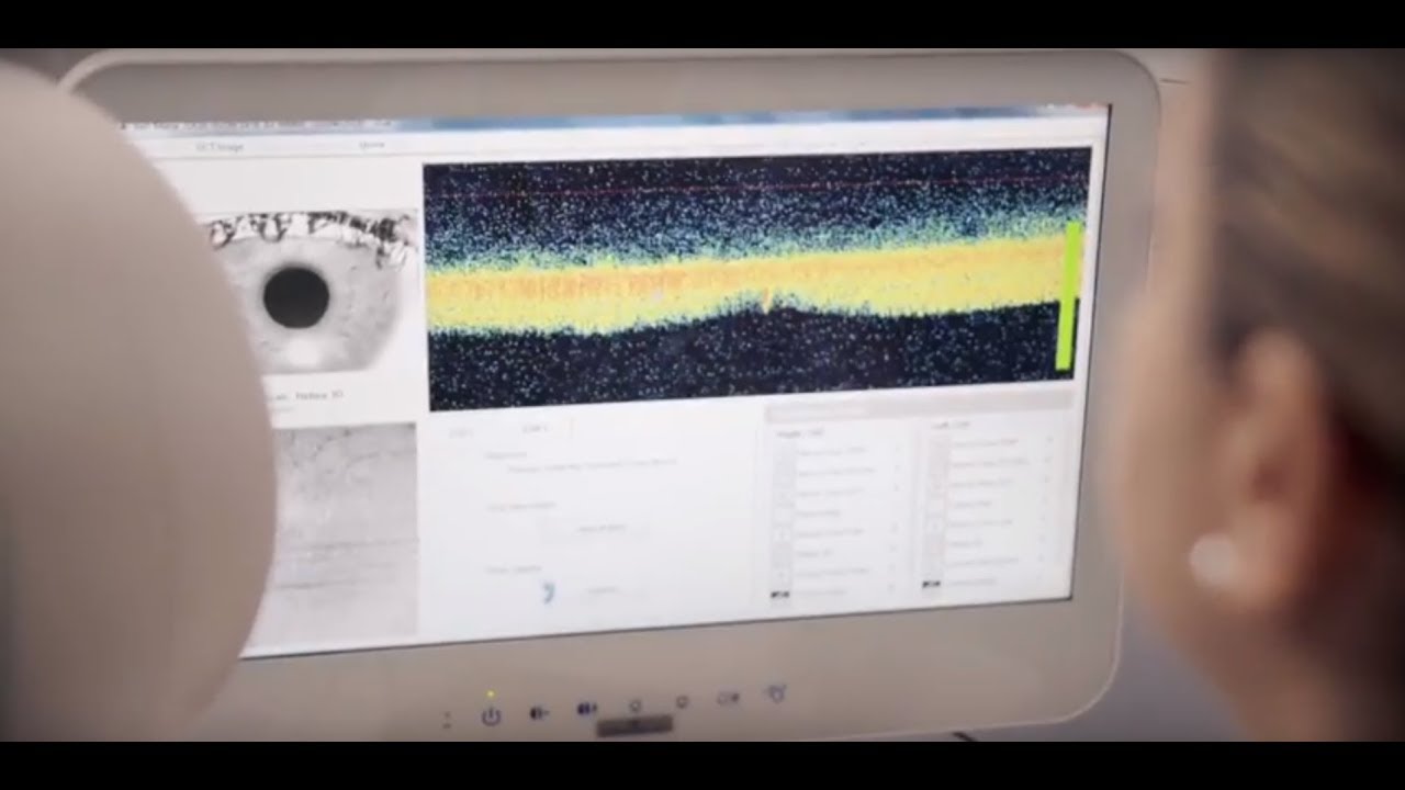 Our Research | Fight for Sight