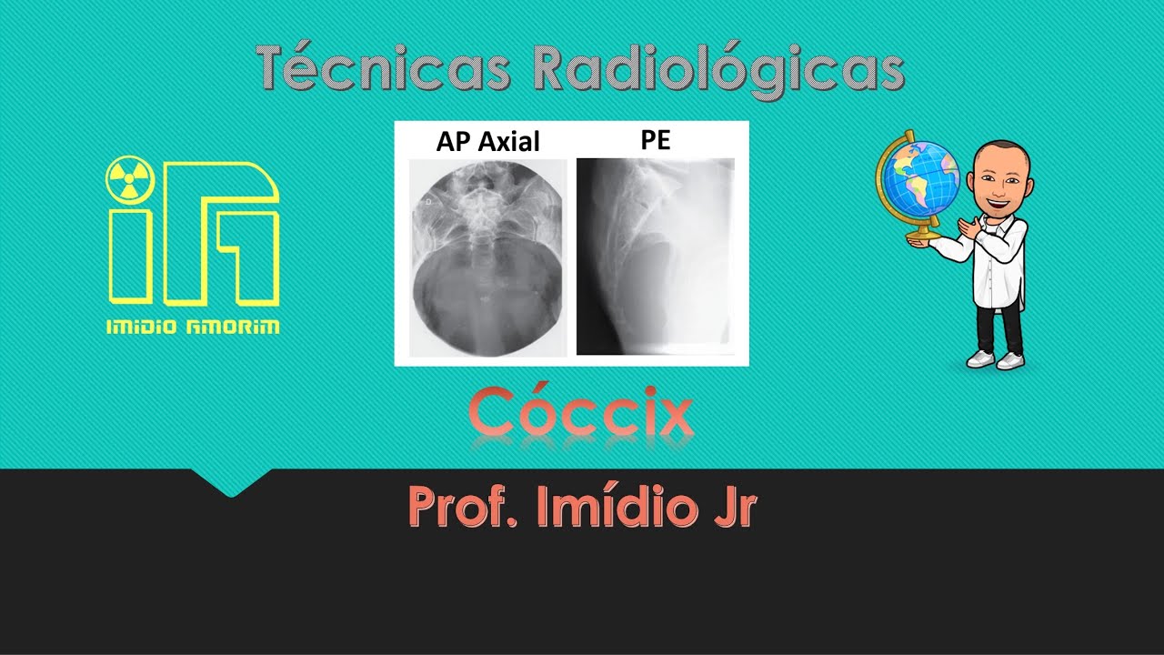Radiografia do Cóccix: AP Axial + Perfil