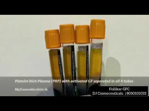 GFC Kit - Growth Factor Concentrate Kit Latest Price, Manufacturers ...