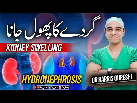 Hydronephrosis - گردے میں پانی بھرنا Urdu Hindi