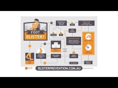 Blister Treatment Blueprint: How To Treat Your Foot Blister Properly!