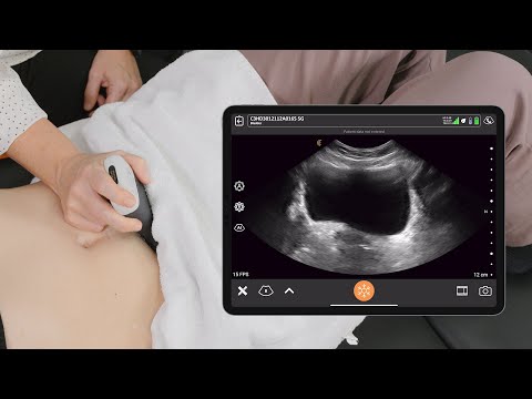 Transabdominal Pelvic Floor Assessment with Ultrasound