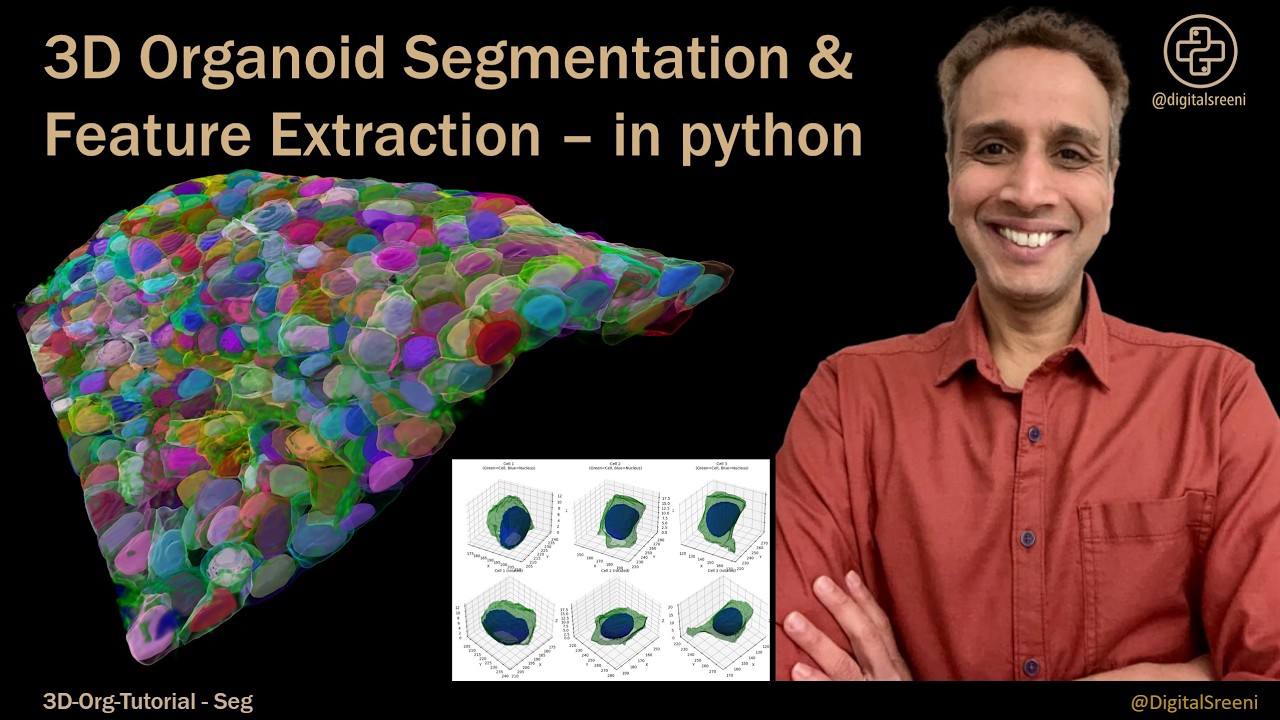 3D Organoid Segmentation and Feature Extraction - in python