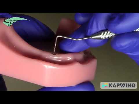 Measuring tissue height for locator abutment