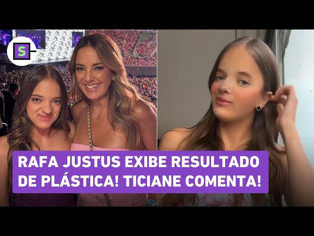 Rafaella Justus compartilha vídeo após fazer cirurgia no nariz