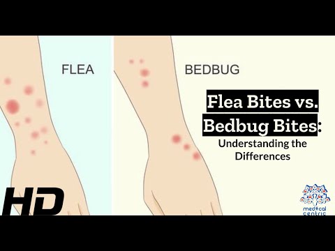 Bug Bite Showdown: Identifying Flea vs. Bedbug Bites
