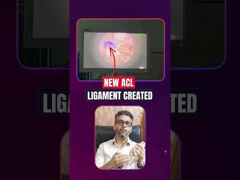 ACL Surgery for Russian Happy patient | Dr Aditya Jain #acl #sportsinjury #patientcare #anatomy #new
