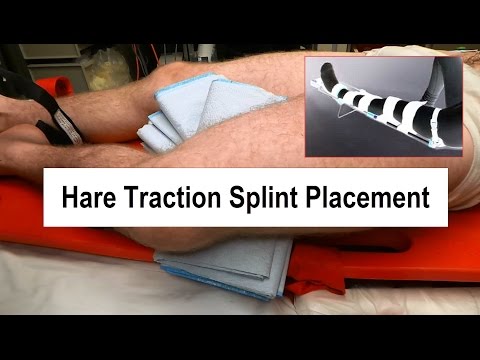 Hare Traction Splint Placement