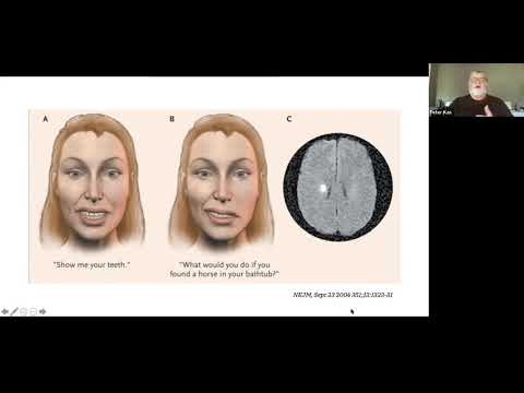 The Rapid Screening Neuro Exam