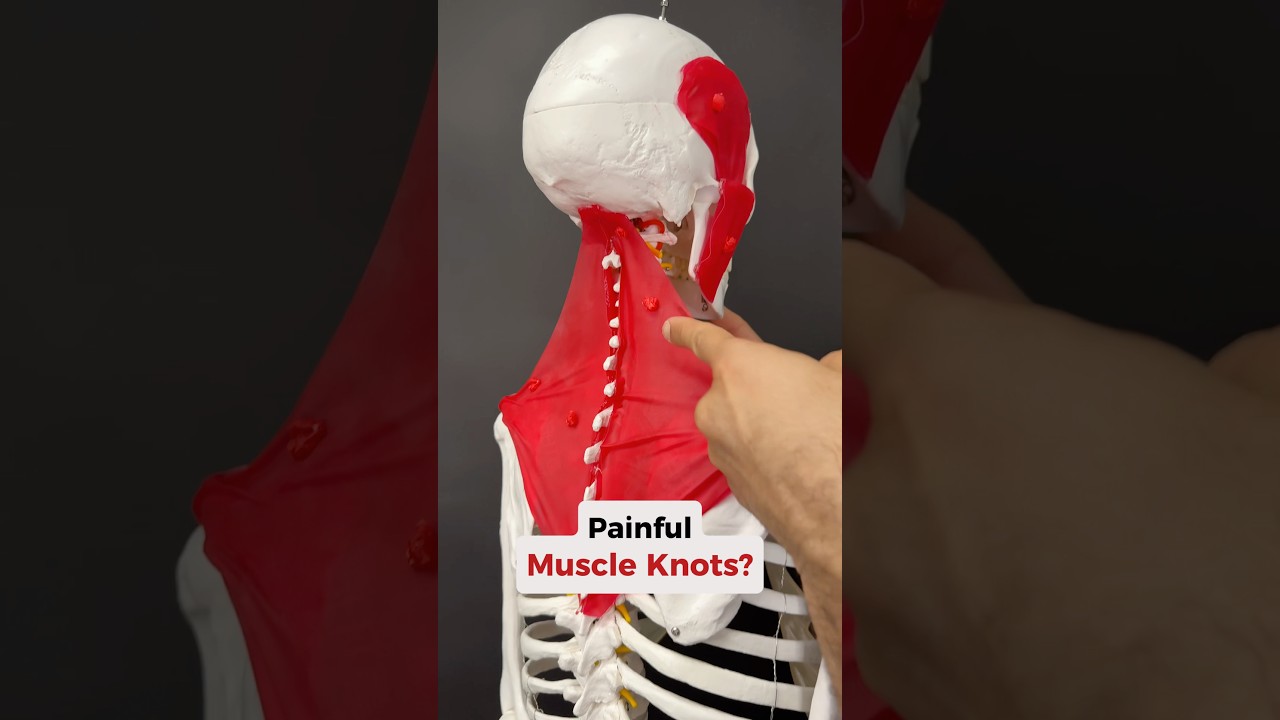 Painful Muscle Knots? These are TRIGGER POINTS— let’s release ‘em! #neckpain #jawpain #musclerelease