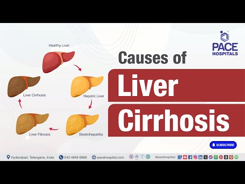 What are the Causes of Liver Cirrhosis? | Reason of Cirrhosis of the Liver | #livercirrhosiscauses