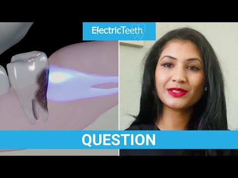Do I have to have a wisdom tooth removed?
