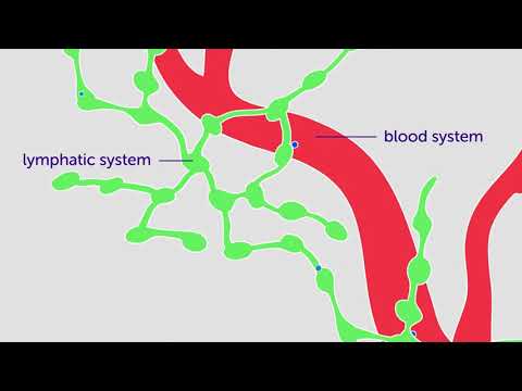 What is Secondary Cancer? | Cancer Research UK