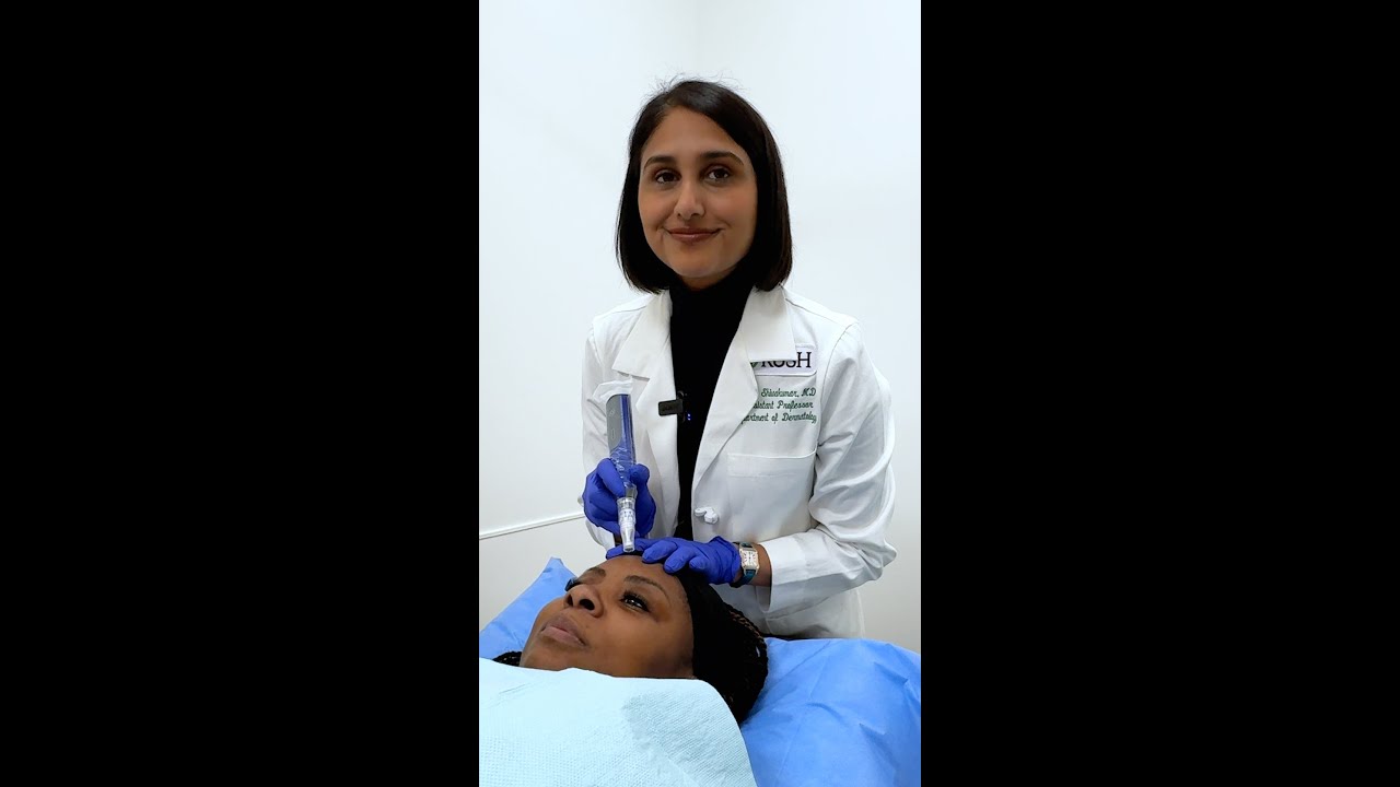 Why Microneedling Is an Ideal Entry-Level Cosmetic Procedure