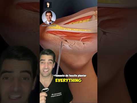 Plantar Fasciitis Treatment