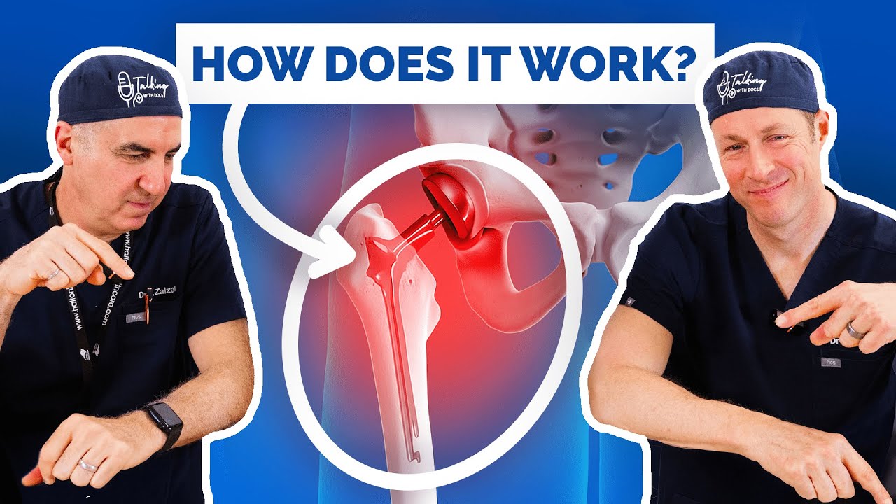 What Really Happens During Hip Replacement Surgery