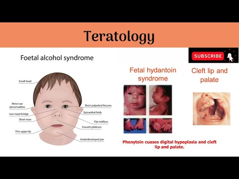 Teratology | Causes of Malformations | Mode of actions of Teratogens #Anatomy #mbbs #education
