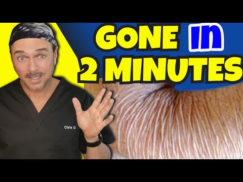 2 Minute Fix For Crepey Skin That Actually Works! | Chris Gibson