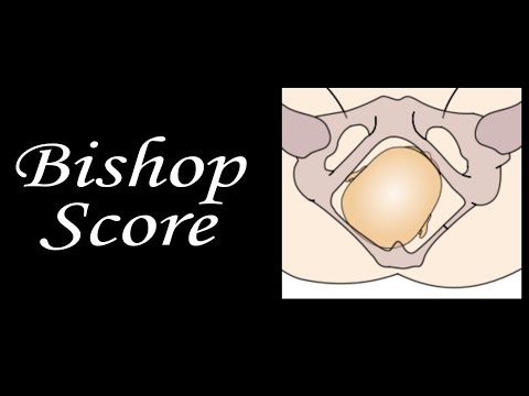 Modified Bishop Score | Cervix Score | Pre Labour Scoring System || Mis.Medicine