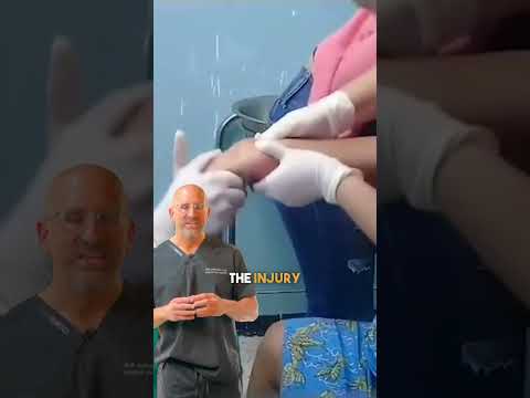 Cranking-on a Wrist Fracture #shorts