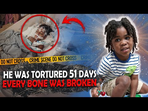 This Case Is So Gruesome Most People Can't Finish It! Incredible Injuries, Like After a Tornado!