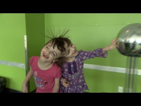 Canadian conjoined twins share brain connection—and experience – Why ...