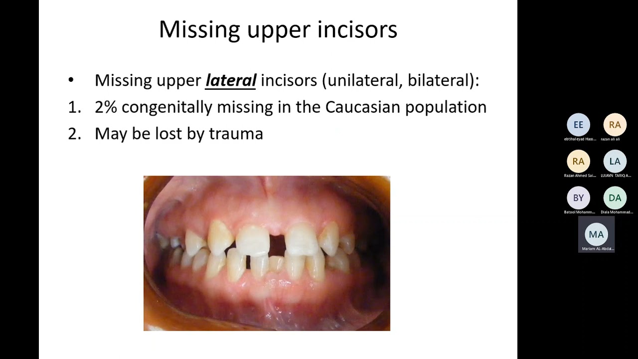 Dr Mariam Class I malocclusion (2)