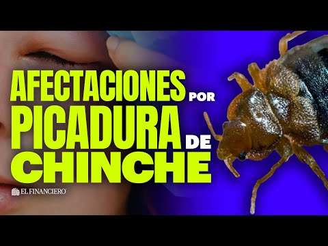 Esta es la enfermedad de Chagas, transmitida por CHINCHES
