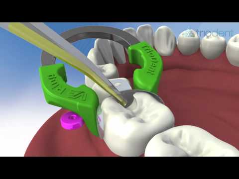 TRIODENT V3 SYSTEM | Inter-Africa Dental