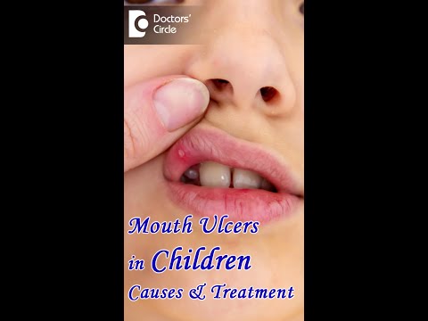 Mouth Ulcers in Children Causes & Treatment - Dr. K Saranya |Doctors' Circle #shorts