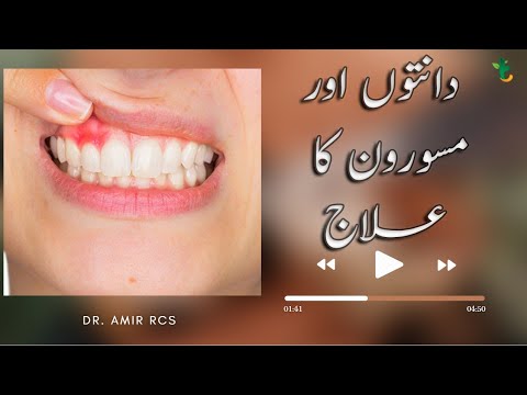 Common Dental Diseases and Treatment in Urdu by Dr Amir Rafique Dentist Islamabad - Tabib.pk