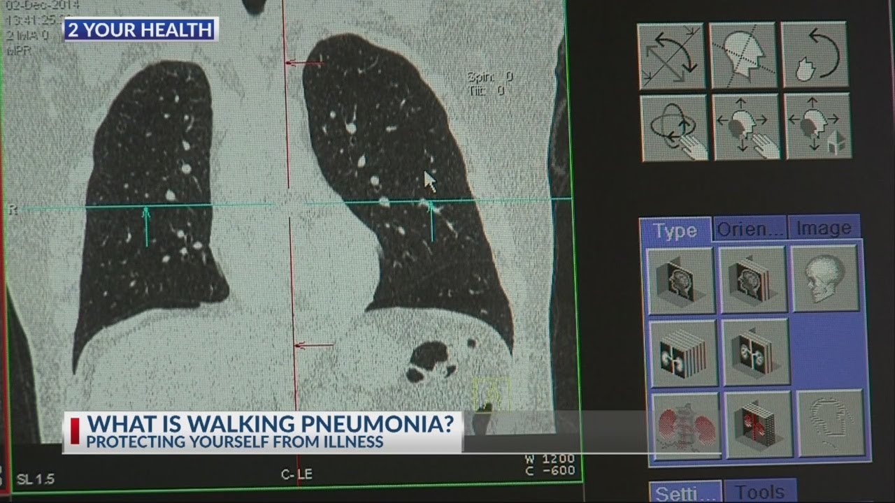 2 Your Health: What is Walking Pneumonia