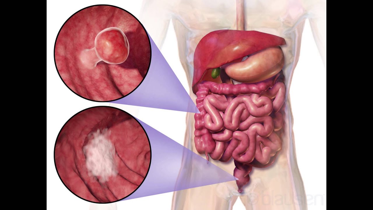 7 REASONS TO STOP EATING RED MEAT